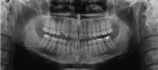 Radio panoramique dentaire - mode d'emploi Eurodentaire