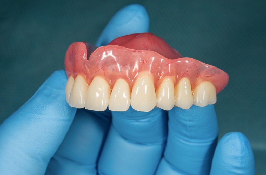 Prothèse dentaire provisoire - Eurodentaire